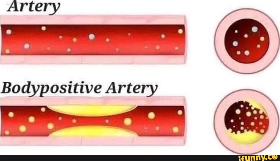 Artery memes. Best Collection of funny Artery pictures on iFunny