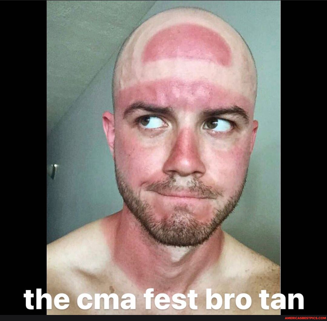 #cma #cmafest #bro #tan #darwinawards - the cma fest bro tan - America ...