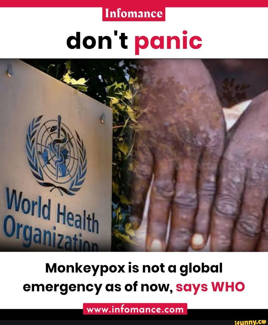 Infomance don't panic Monkey pox is not a global emergency as of now ...