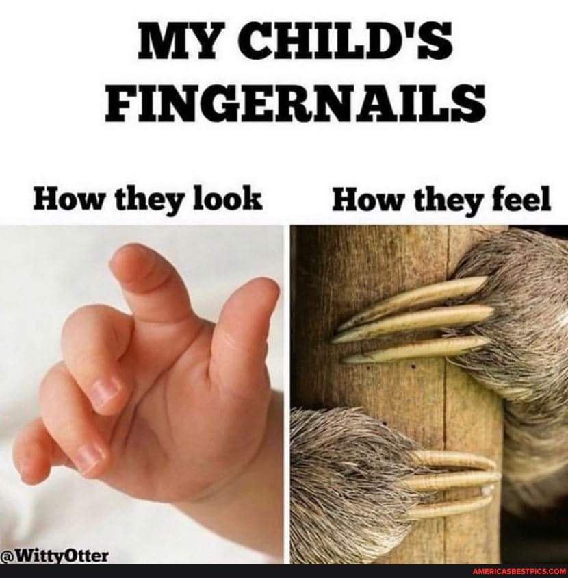 MY CHILD'S FINGERNAILS How they look How they feel - America’s best ...