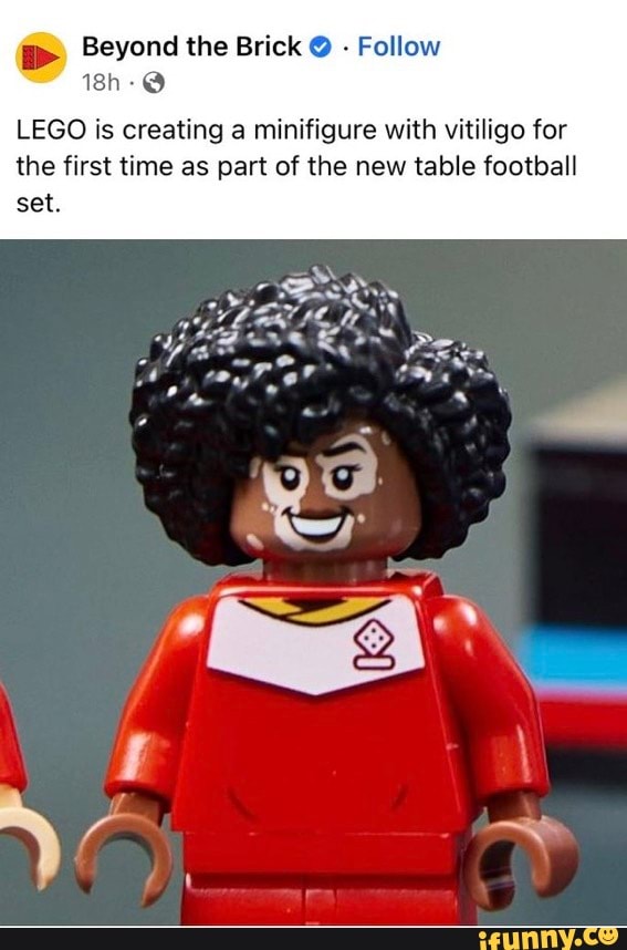 Beyond the Brick @ - Follow LEGO is creating a minifigure with vitiligo ...