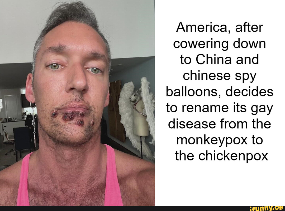 Chickenpox memes. Best Collection of funny Chickenpox pictures on iFunny