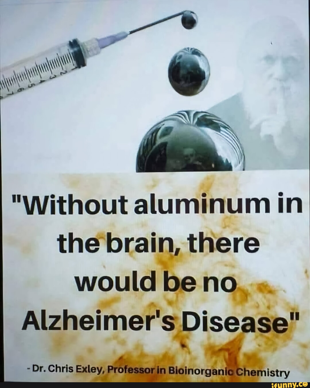 "Without aluminum in the brain, there would be no, Alzheimer's Disease ...