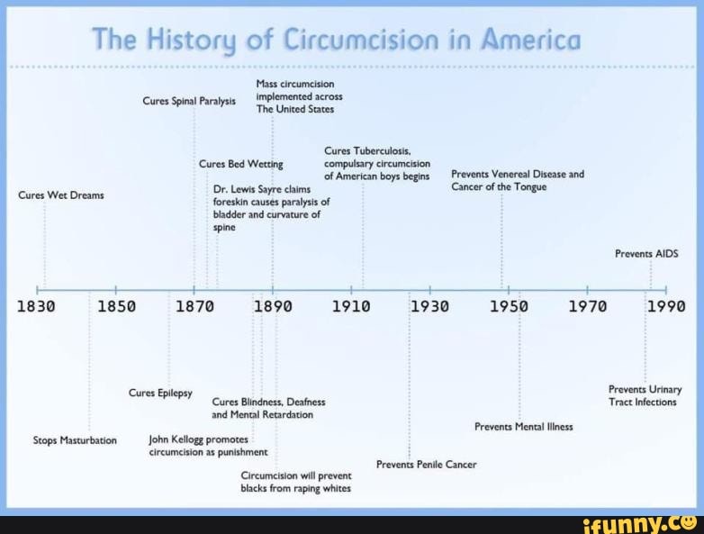The History of Circumcision in America 'Mass circumcision Com Spin Para ...