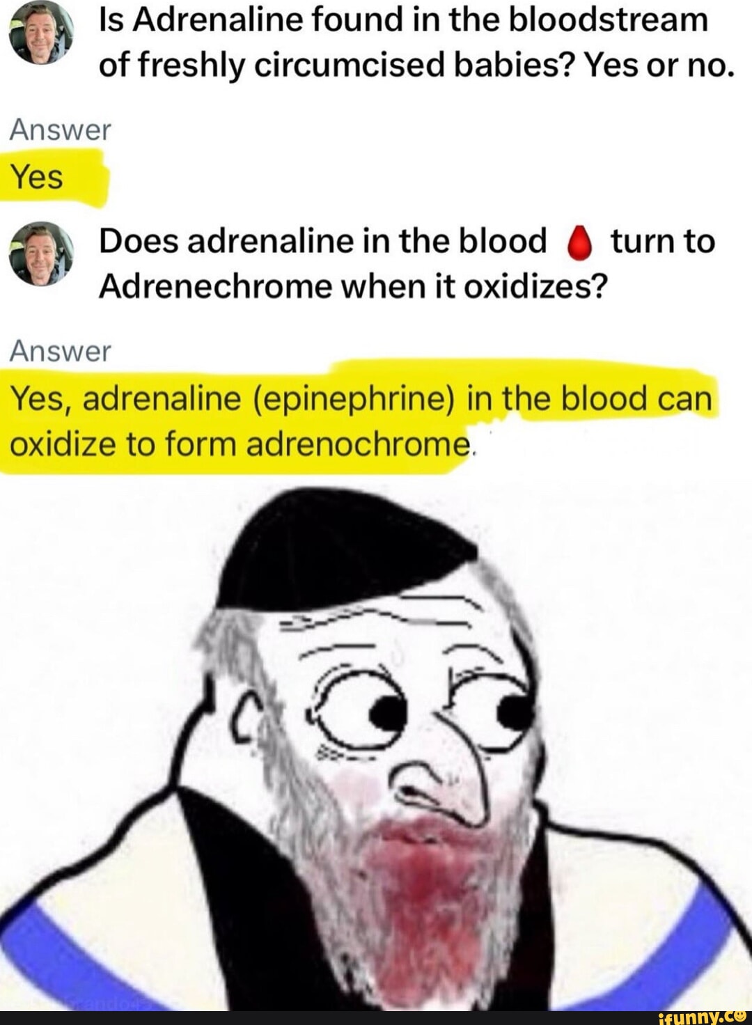 Is Adrenaline found in the bloodstream of freshly circumcised babies ...