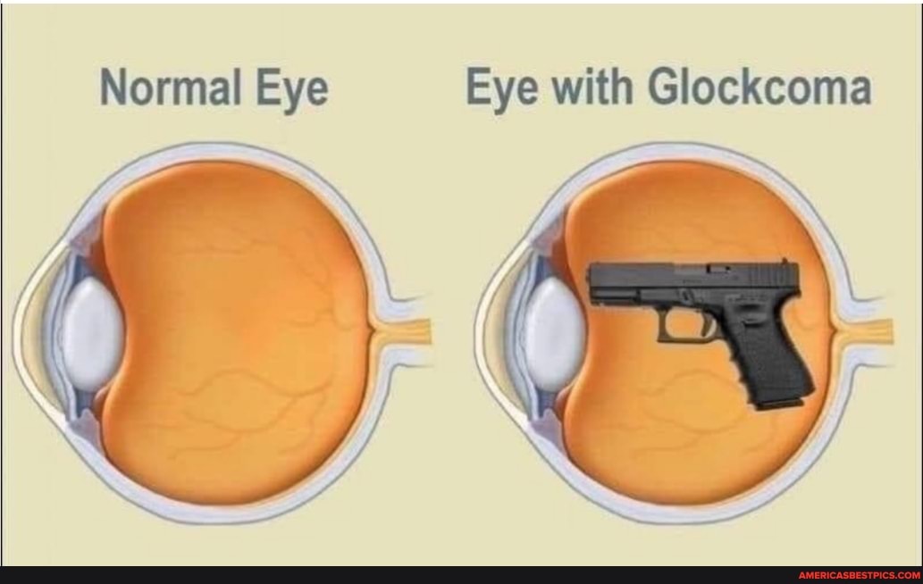 Normal Eye Eye with Glockcoma - America’s best pics and videos