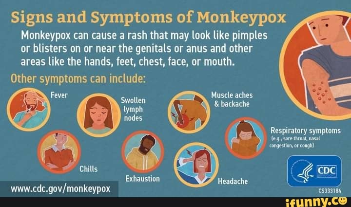Signs and Symptoms of Monkeypox Monkeypox can cause a rash that may ...