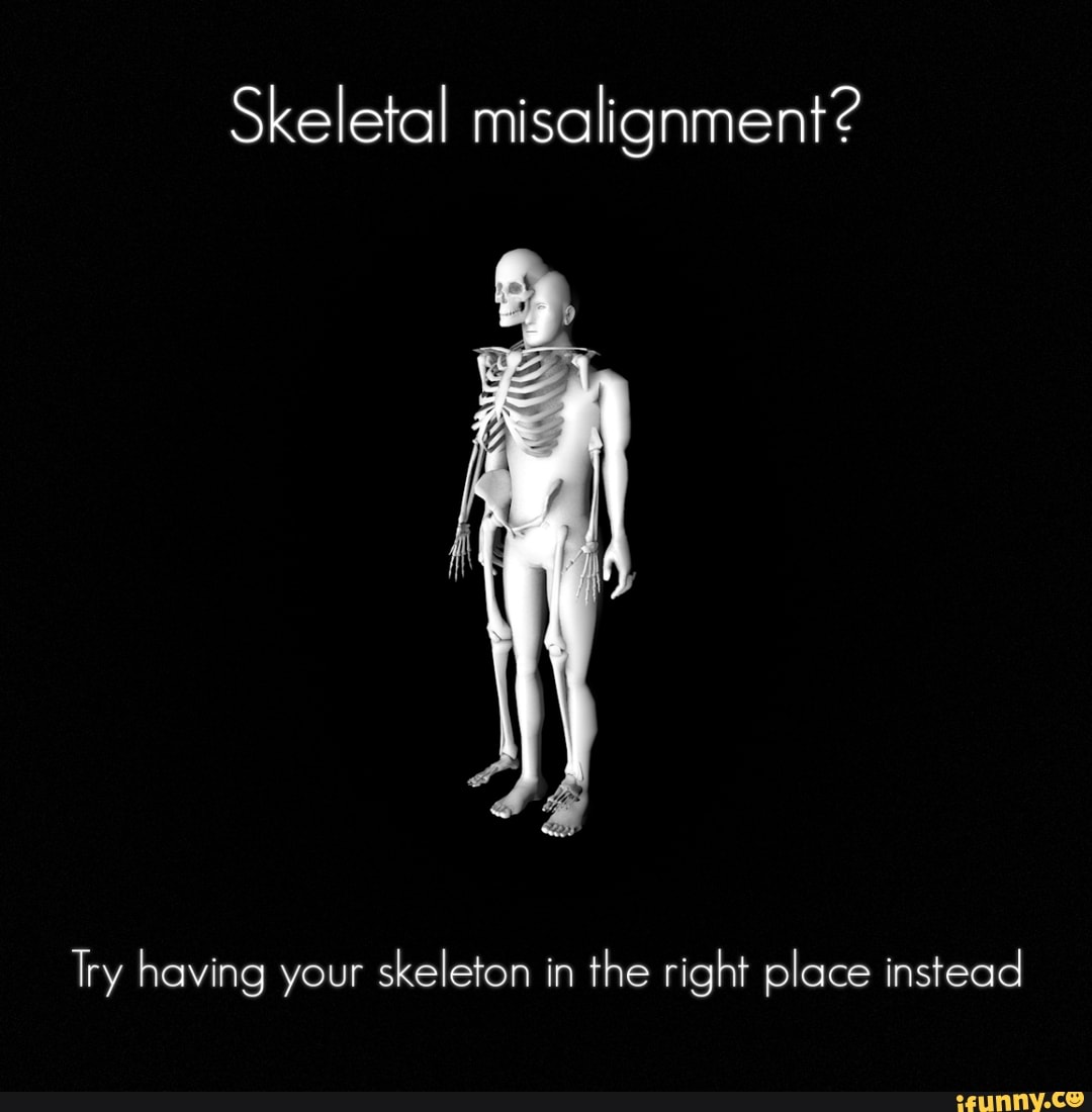Skeletal misalignment? Try having your skeleton in the right place ...