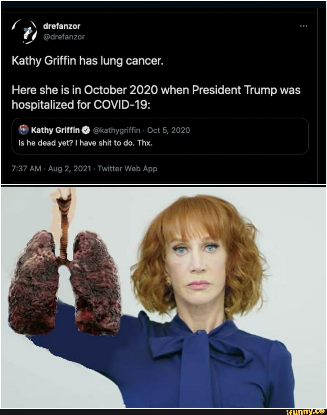 Drefanzor memes. Best Collection of funny Drefanzor pictures on iFunny