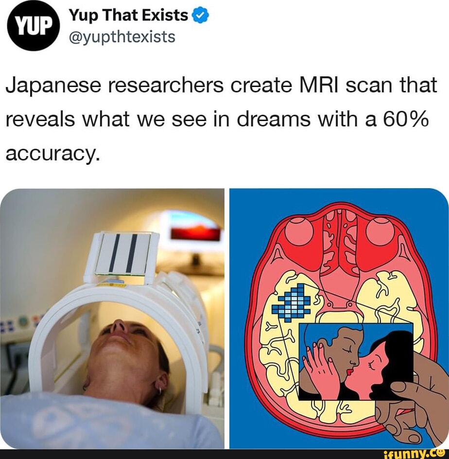 Yup That Exists @yupthtexists Japanese researchers create MRI scan that ...