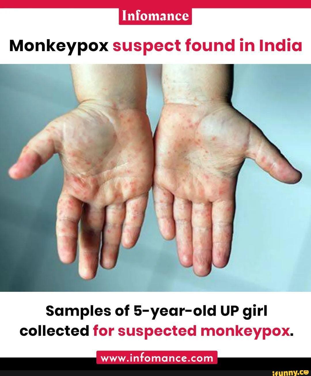 Rashes memes. Best Collection of funny Rashes pictures on iFunny