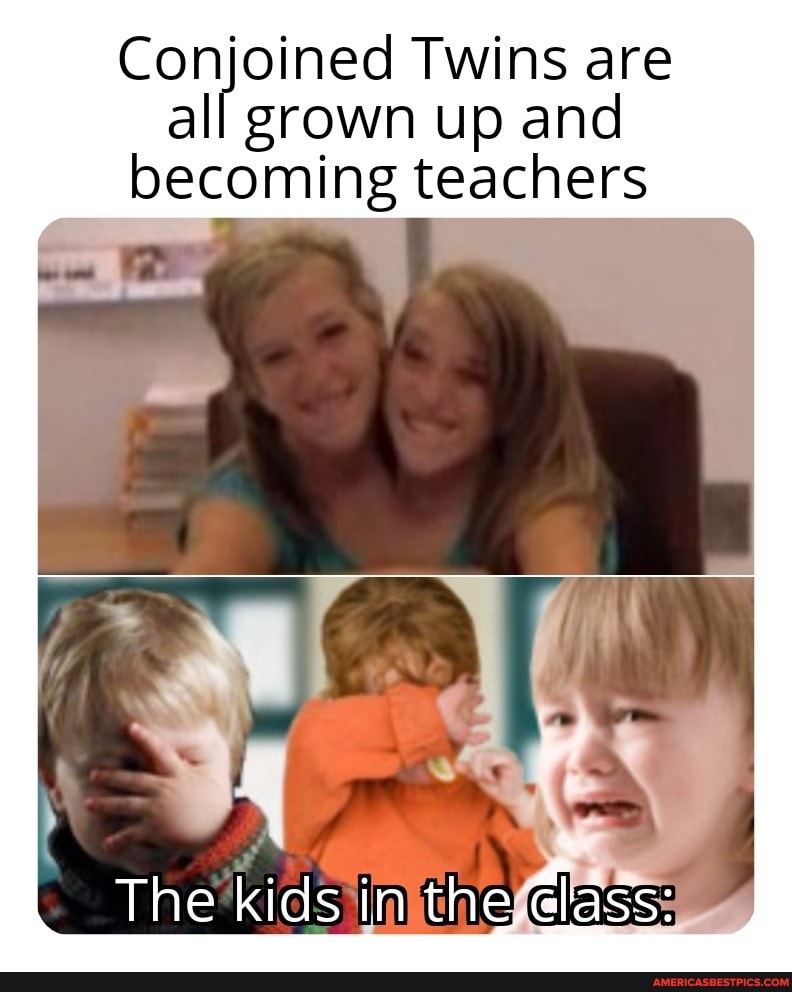Conjoined Twins are all grown up and becoming teachers The kids in the ...