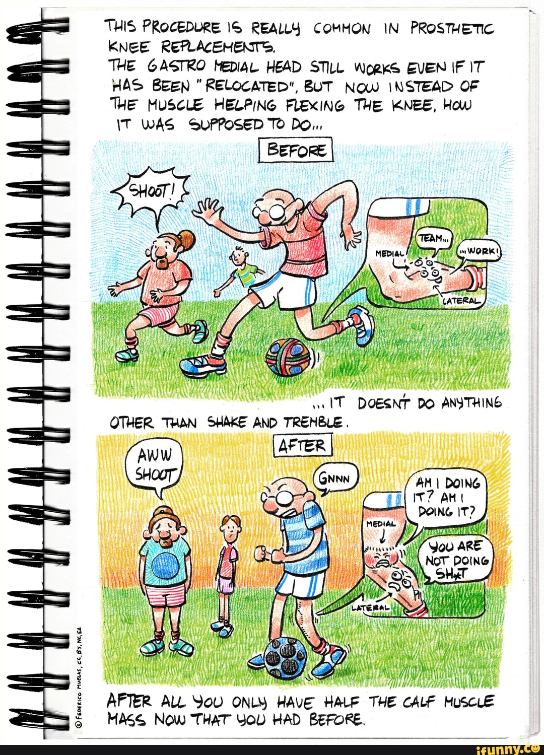 THIS PROCEDURE IS REALLY COMHON IN PROSTHETIC KNEE REPLACEHENTS, THE ...