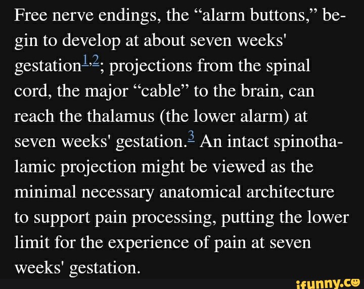 Projections memes. Best Collection of funny Projections pictures on iFunny