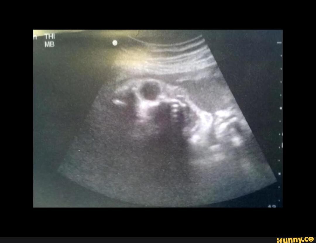 Cursed_baby memes. Best Collection of funny Cursed_baby pictures on iFunny