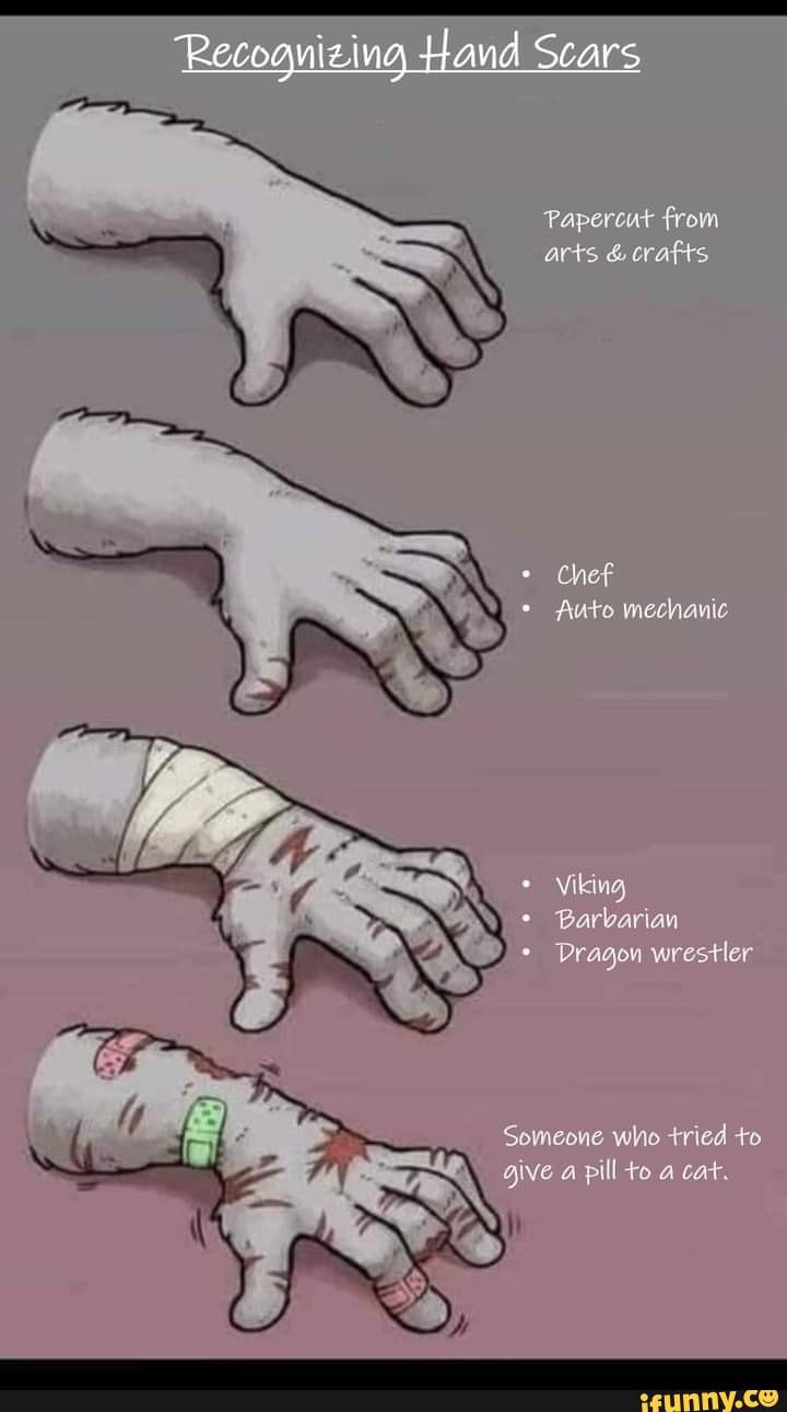 Recognizing Hand Scars Papercut from arts & crafts * Chef Auto mechanic ...