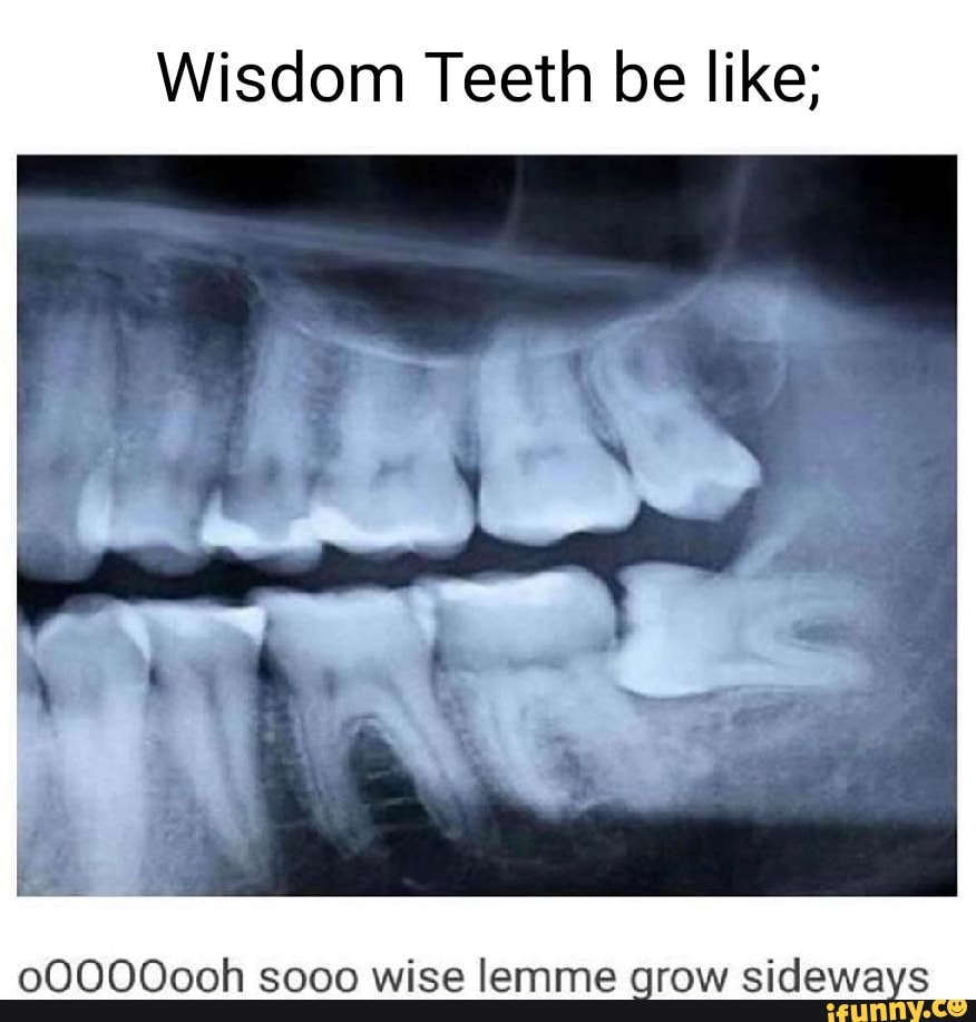 Wisdom Teeth be like; oOO0O0O0ooh sooo wise lemme grow sideways - iFunny