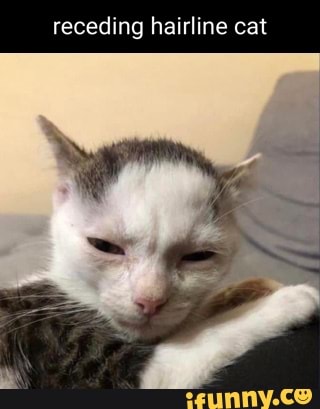 Recedinghairline memes. Best Collection of funny Recedinghairline ...