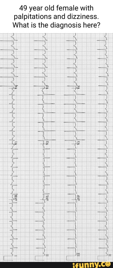 Dizziness memes. Best Collection of funny Dizziness pictures on iFunny