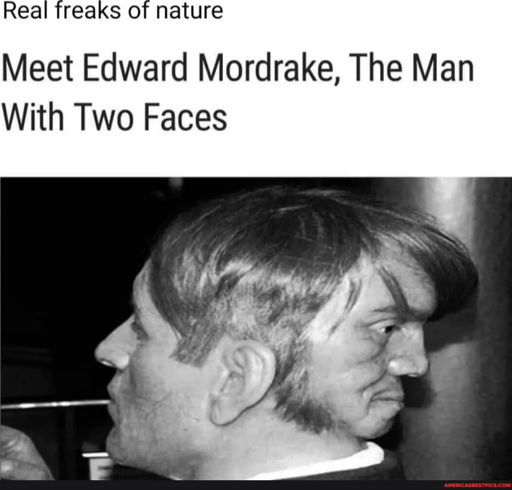 Real freaks of nature Meet Edward Mordrake, The Man With Two Faces ...