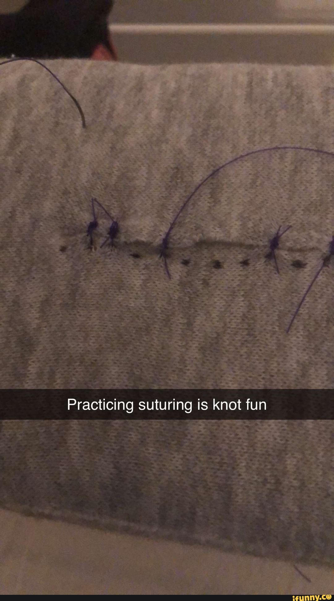Suturing memes. Best Collection of funny Suturing pictures on iFunny