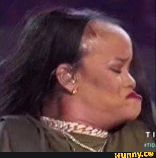 Underbite memes. Best Collection of funny Underbite pictures on iFunny