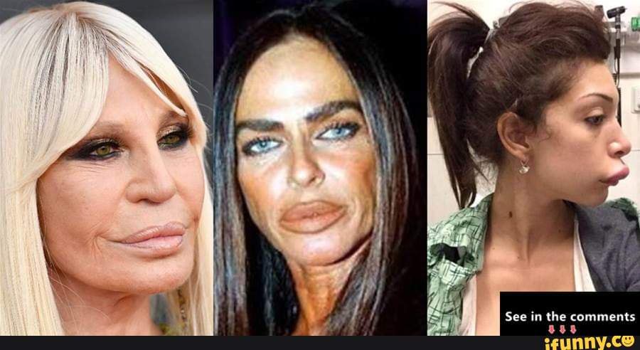 Top 7 Celebs Who Ruined Their Faces Through Plastic Surgery - iFunny