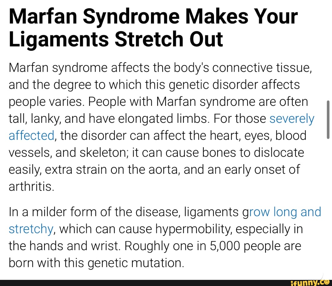 Marfan Syndrome Makes Your Ligaments Stretch Out Marfan syndrome ...