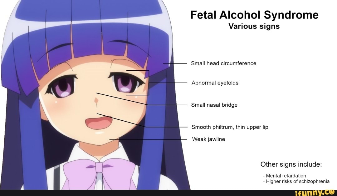 Eyefolds memes. Best Collection of funny Eyefolds pictures on iFunny