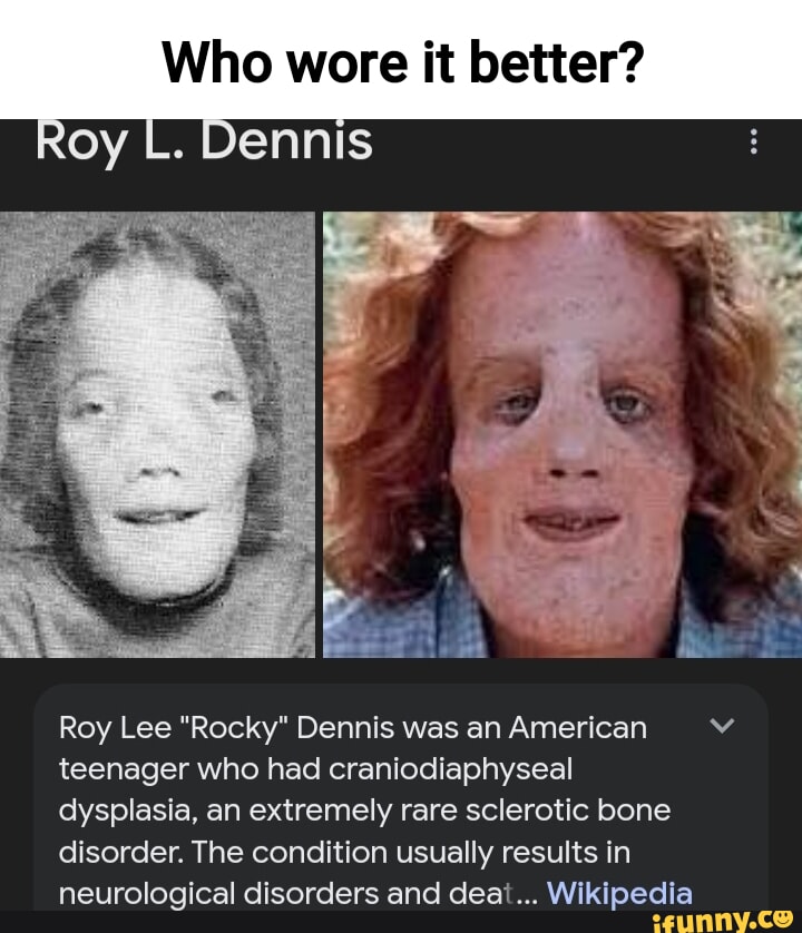 Who wore it better? Roy L. Dennis Roy Lee "Rocky" Dennis was an ...