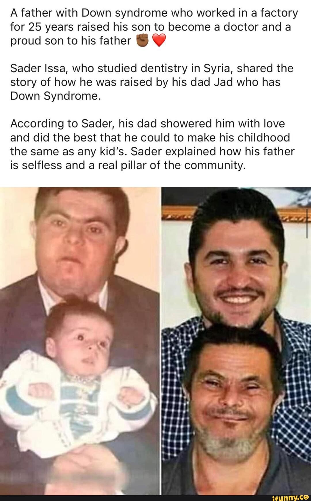 A father with Down syndrome who worked in a factory for 25 years raised ...