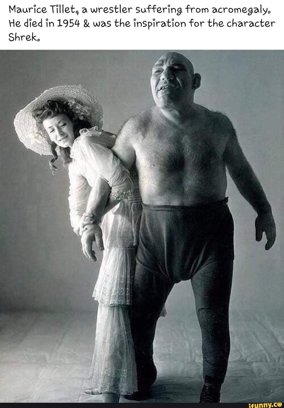 Acromegaly memes. Best Collection of funny Acromegaly pictures on iFunny