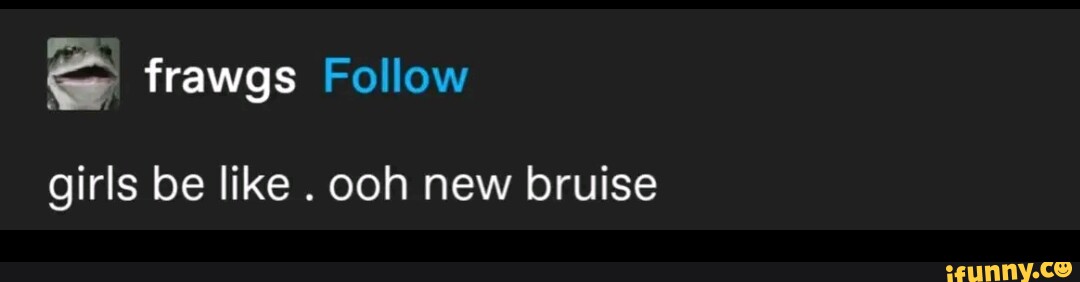 Bruise memes. Best Collection of funny Bruise pictures on iFunny