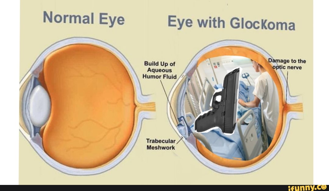 Glockoma memes. Best Collection of funny Glockoma pictures on iFunny