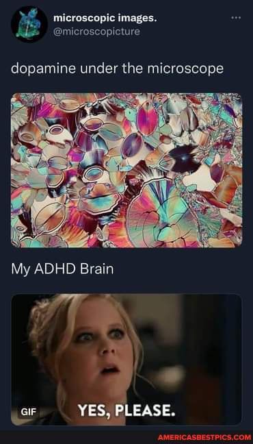 Images, dopamine under the microscope My ADHD Brain GIF YES, PLEASE ...