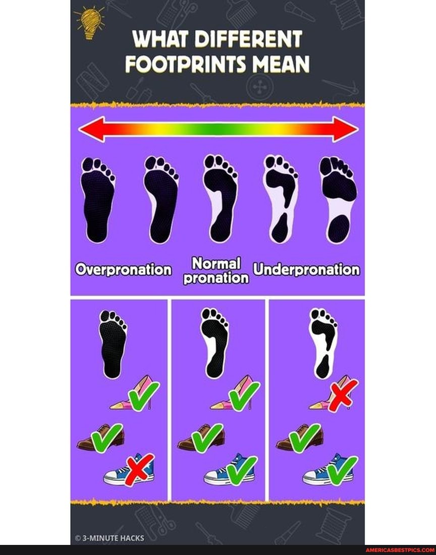 WHAT DIFFERENT FOOTPRINTS MEAN Normal Overpronation Normal pronation ...