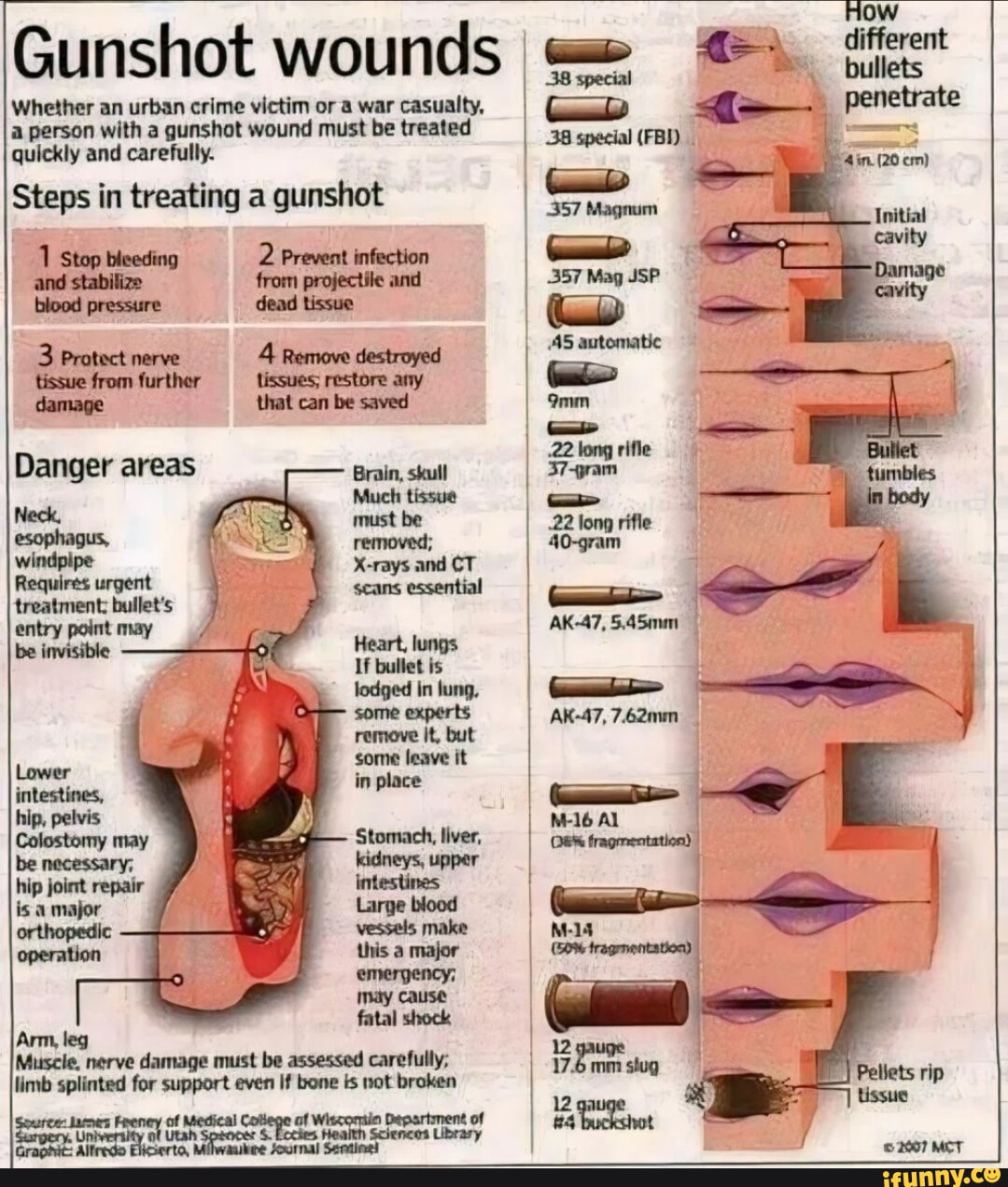 Gunshot wounds I Whether an urban crime victim or a war casualty, a ...