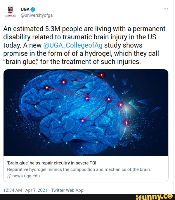 Neuroscience memes. Best Collection of funny Neuroscience pictures on ...