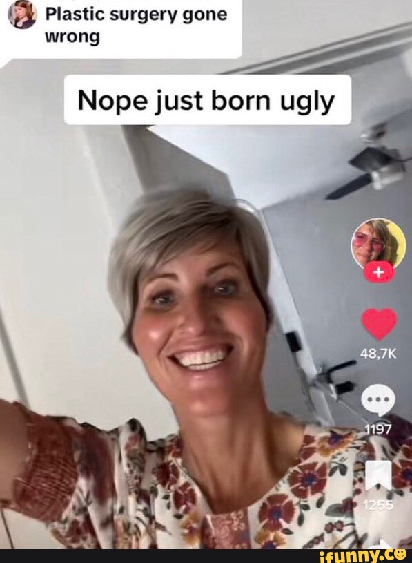 Plastic surgery gone wrong Nope just born ugly aN - iFunny
