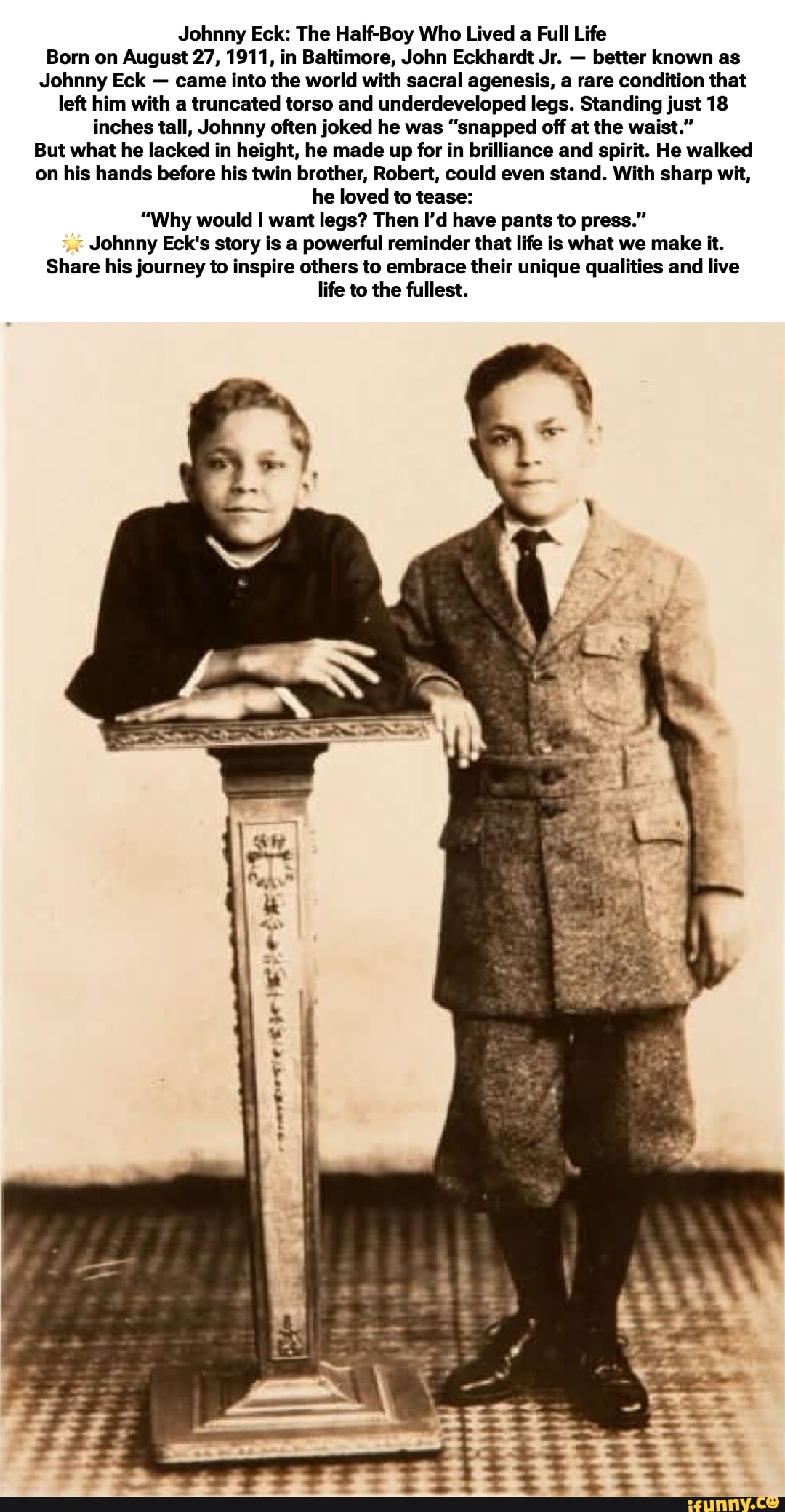 Johnny Eck: The Half-Boy Who Lived a Full Life Born on August 27, 1911 ...