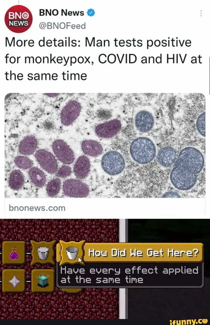 BNO News @BNOFeed More details: Man tests positive for monkeypox, COVID ...