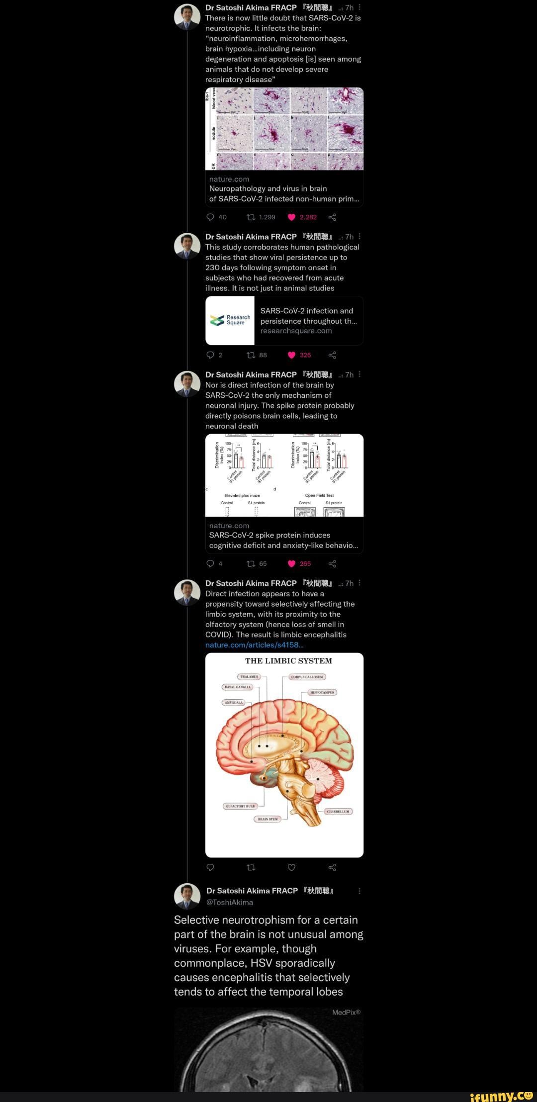 Microhemorthages memes. Best Collection of funny Microhemorthages ...