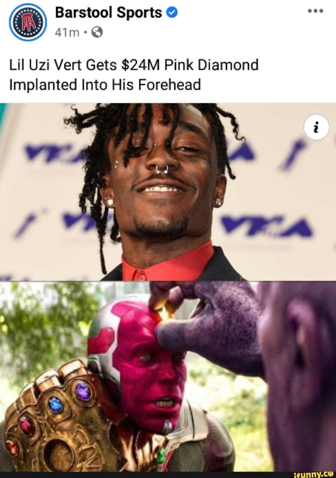 Lil Uzi Vert Gets Pink Diamond Implanted Into His Forehead - iFunny