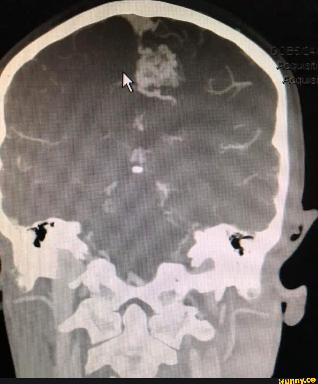 Avm memes. Best Collection of funny Avm pictures on iFunny