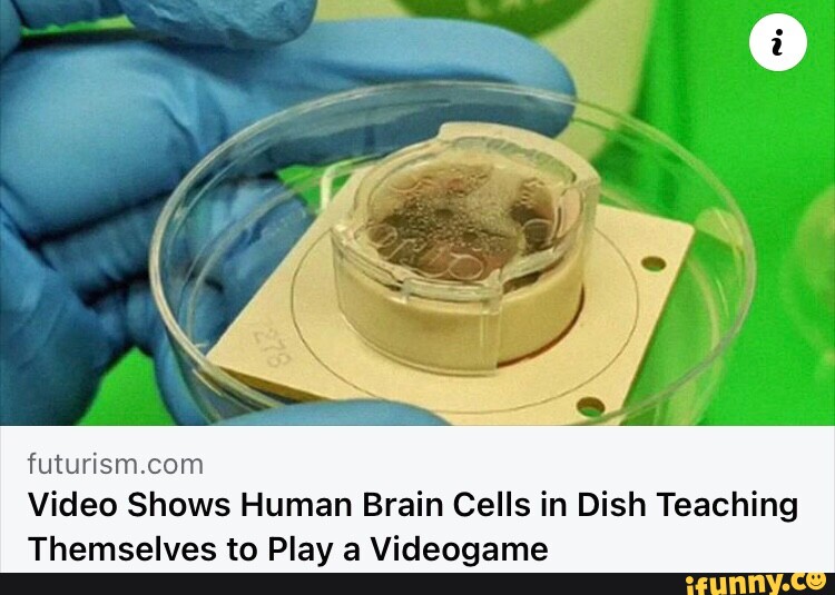Video Shows Human Brain Cells in Dish Teaching Themselves to Play a ...
