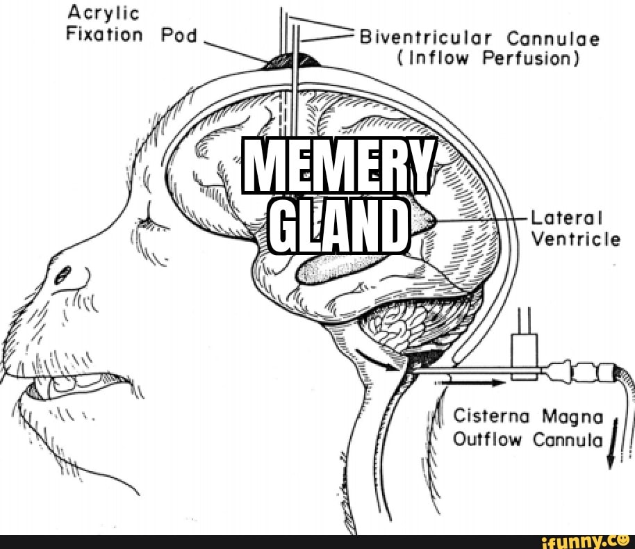 Acrylic Fixation Pod Biventricular Cannuloe (Inflow Perfusion) Lateral ...