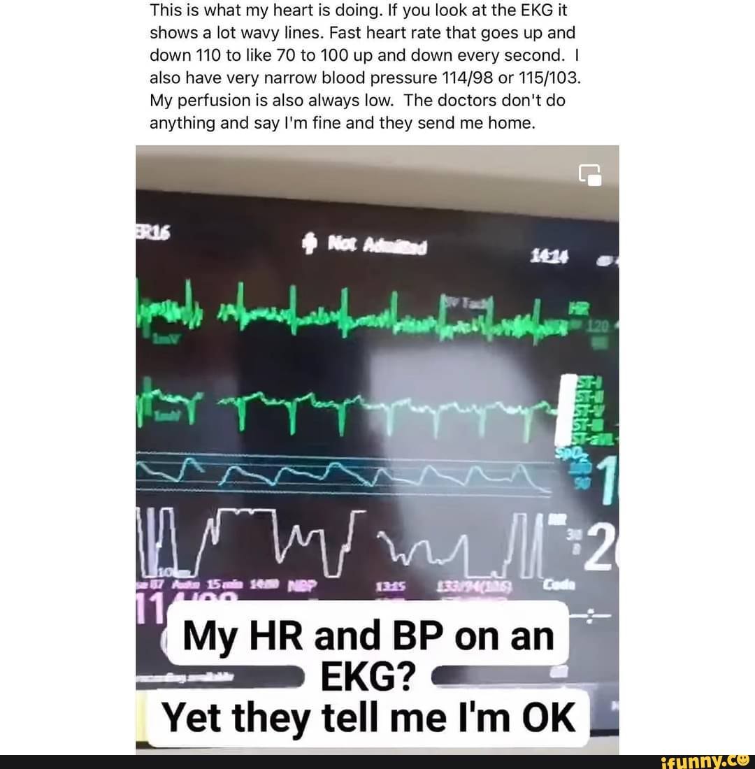 Perfusion memes. Best Collection of funny Perfusion pictures on iFunny
