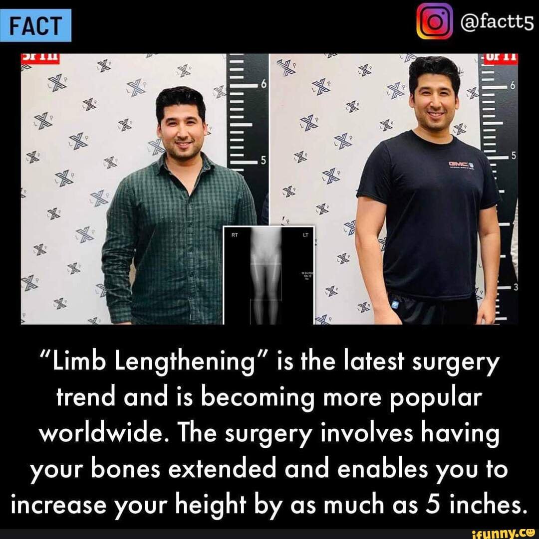 FACT "Limb Lengthening" is the latest surgery trend and is becoming ...