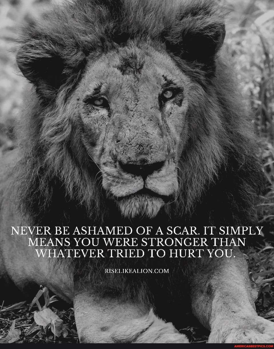 ES \ NEVER BE ASHAMED OF A SCAR. IT SIMPLY MEANS YOU WERE STRONGER THAN ...