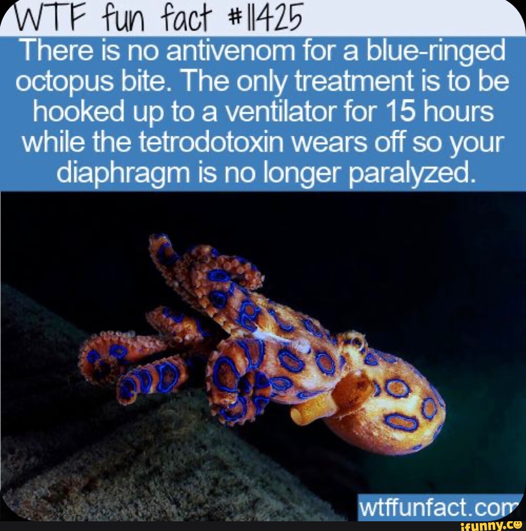 Diaphragm memes. Best Collection of funny Diaphragm pictures on iFunny